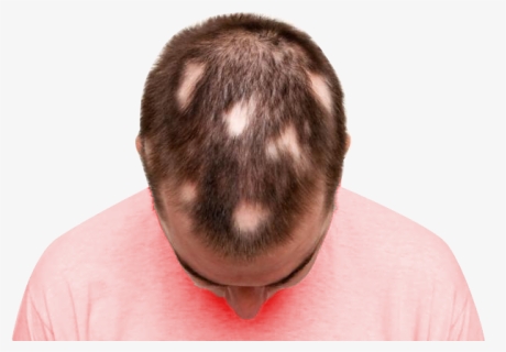 Men Hair Png - Men Hair Wig Png, Transparent Png , Transparent Png ...