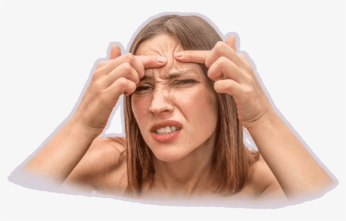 Acne, HD Png Download , Transparent Png Image - PNGitem