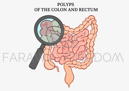 Intestine PNG Images, Transparent Intestine Image Download - PNGitem